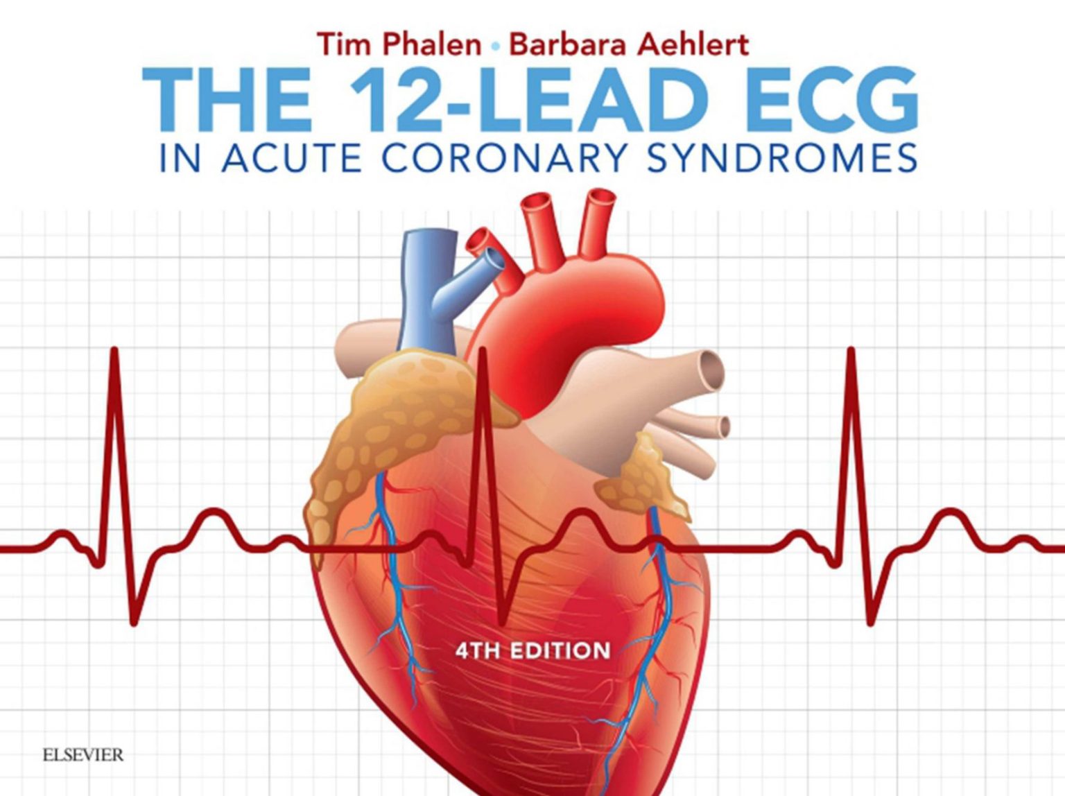 The 12-Lead ECG in Acute Coronary Syndromes E-Book, 4th Edition (PDF ...