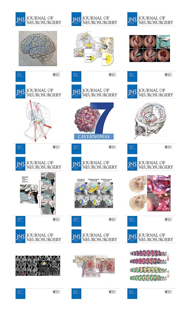 Journal of Neurosurgery 2021 Full Archives (True PDF) | Medical Books ...